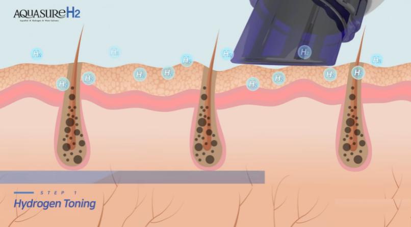 Skin care treatments for face, neck, cleavage, chemical peelings ...